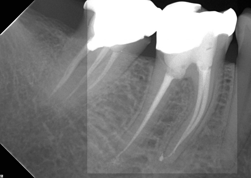 Endorevision 46 | Zahnnotizen