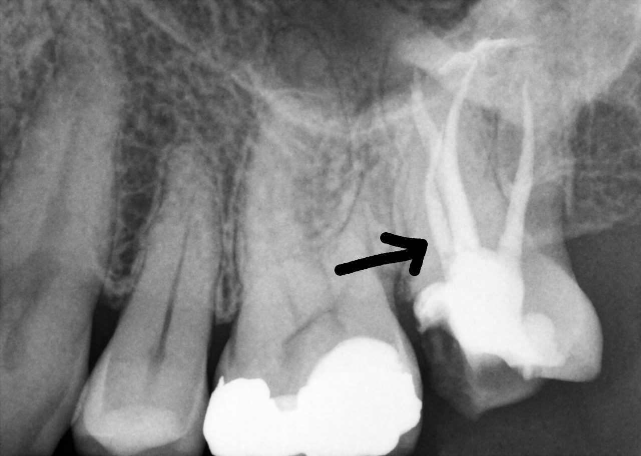 Zahnnotizen | Über Zähne und Menschen